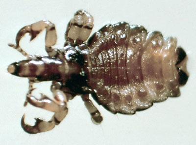 Anoplura; Piolhos Sugadores; Haematopinus; Hoplopleura; Linognathus ...